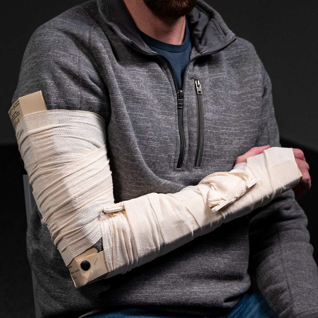 RIGID IMMOBILISATION SYSTEM FOR EXTREMITIES (RISE) – MEDDEV